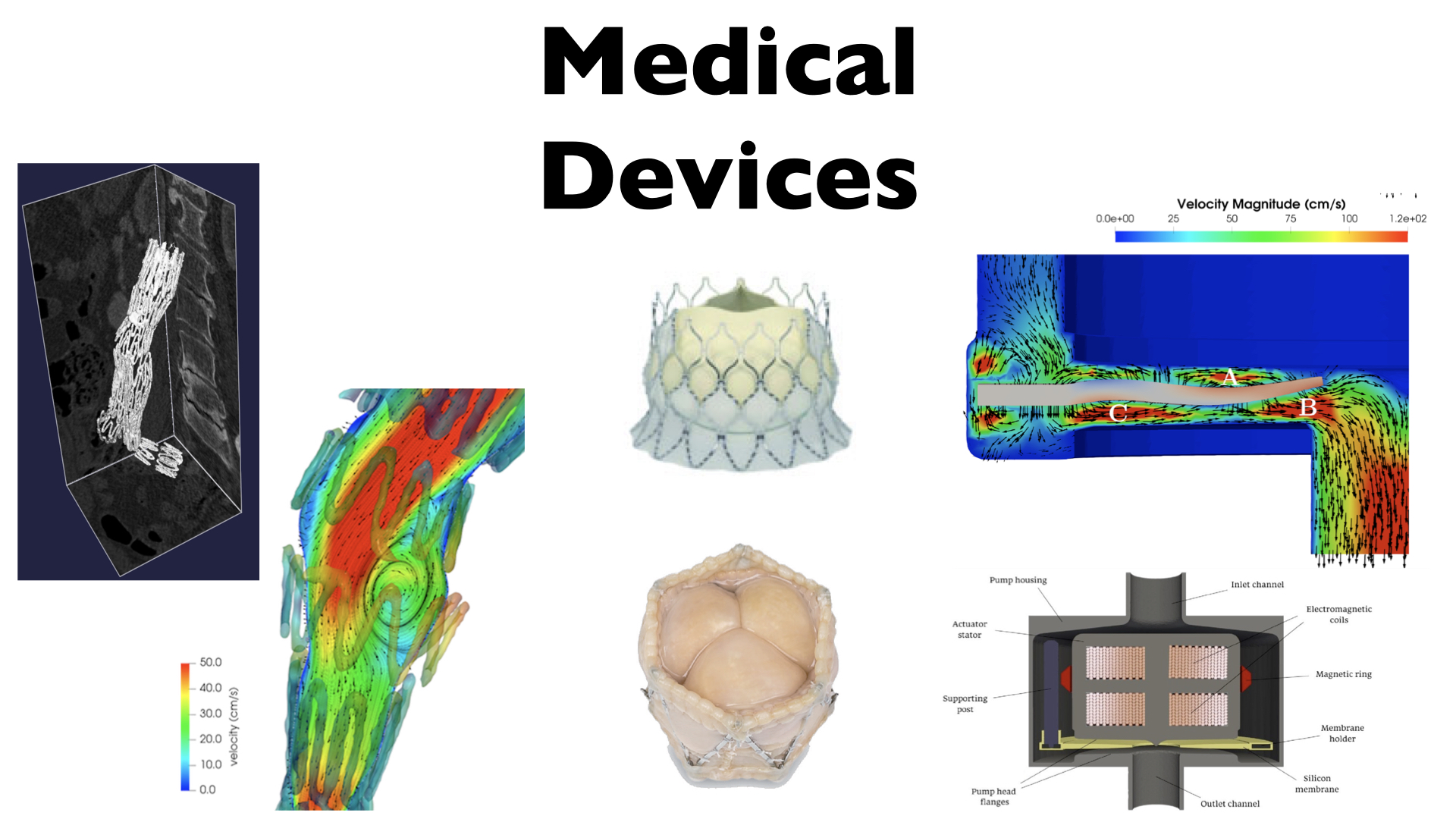 Computational Medicine for the Cardiocirculatory System